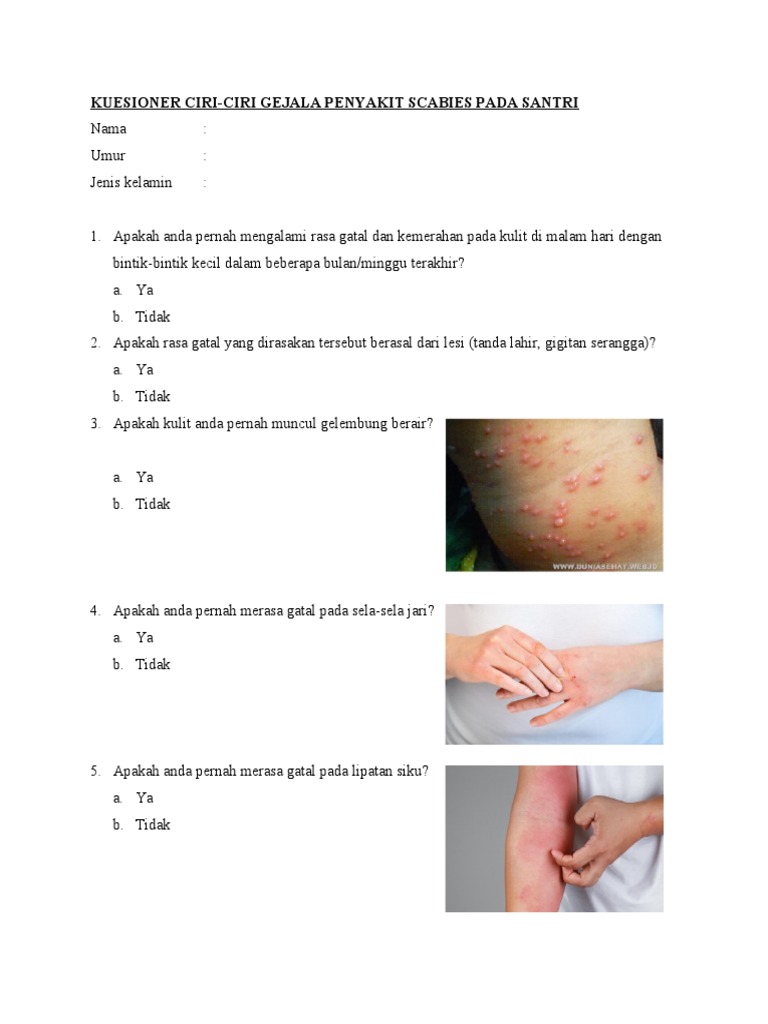 Kuesioner Ciri-Ciri Gejala Penyakit Scabies Pada Santri | PDF