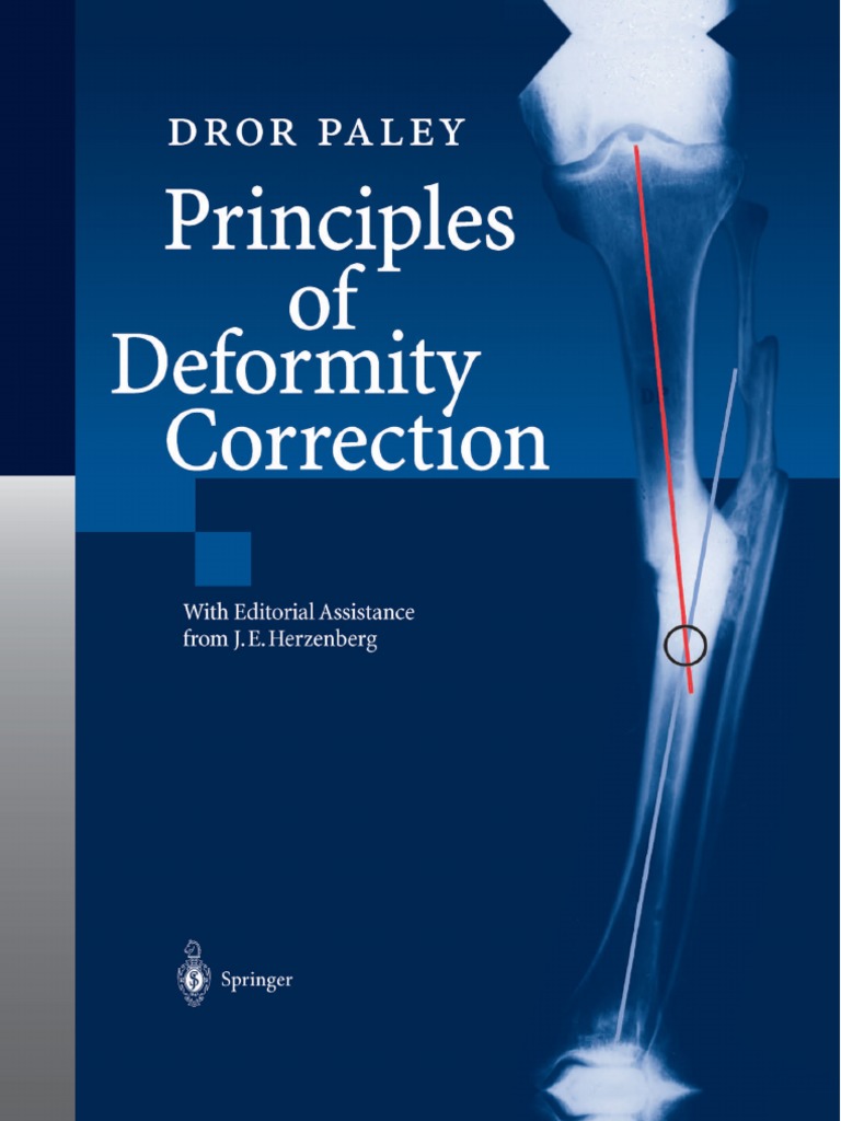 Dror Paley - Principles of Deformity Correction (2002, Springer-Verlag ...
