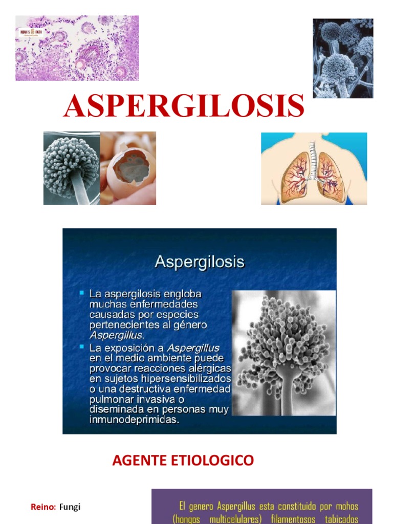 Aspergilosis | PDF | Alergia | Enfermedades animales