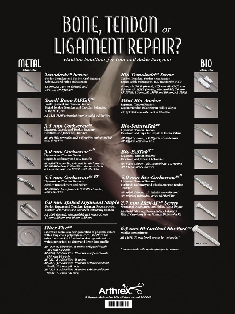 Arthrex Anchors | PDF | Ankle | Surgical Suture
