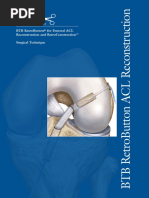 Acl Tightrope Attachable Button System | PDF | Musculoskeletal System ...