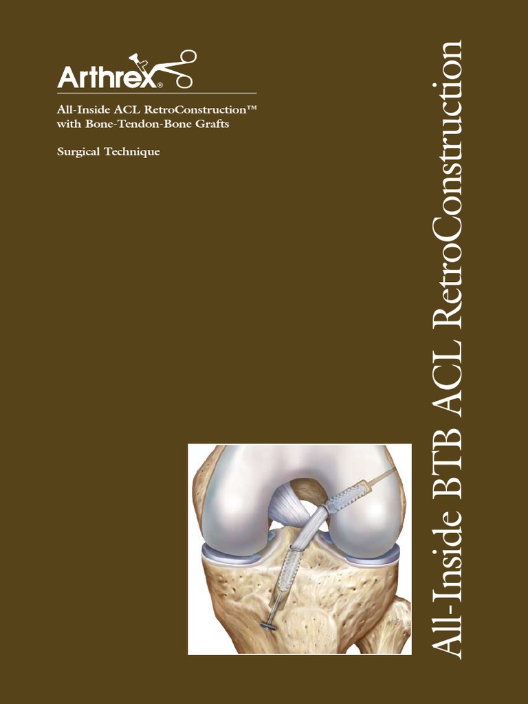 Arthrex All Inside ACL Repair BTB | Download Free PDF | Knee ...