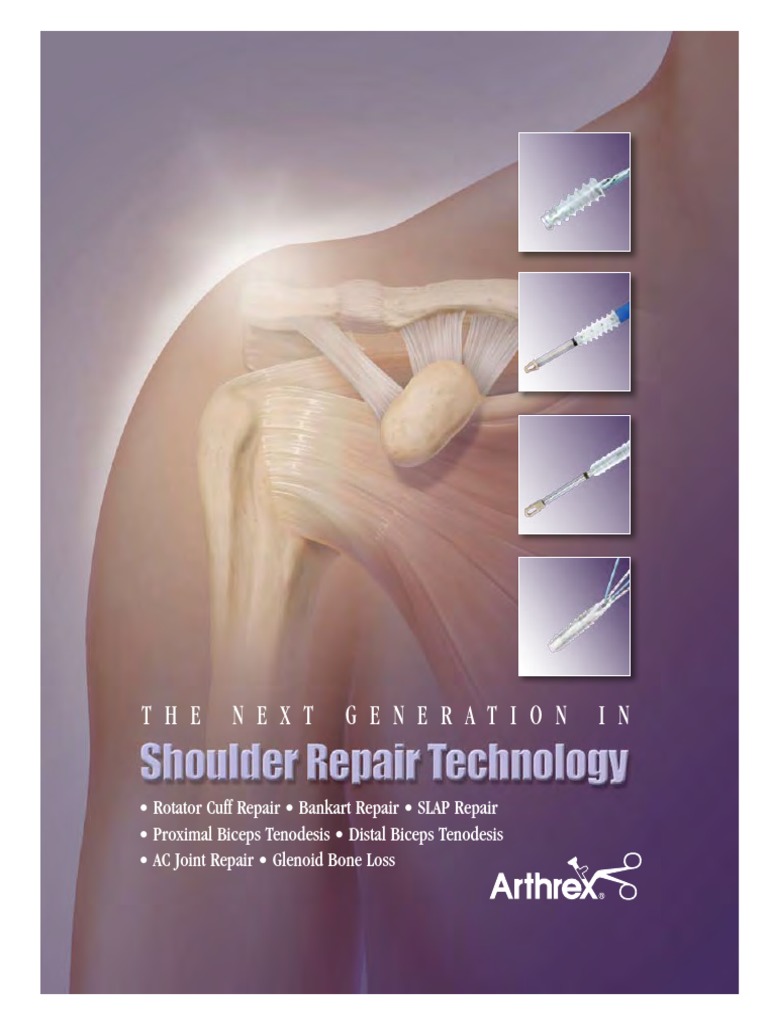 Arthrex Shoulder Repair Tehnology | PDF | Surgical Suture | Shoulder