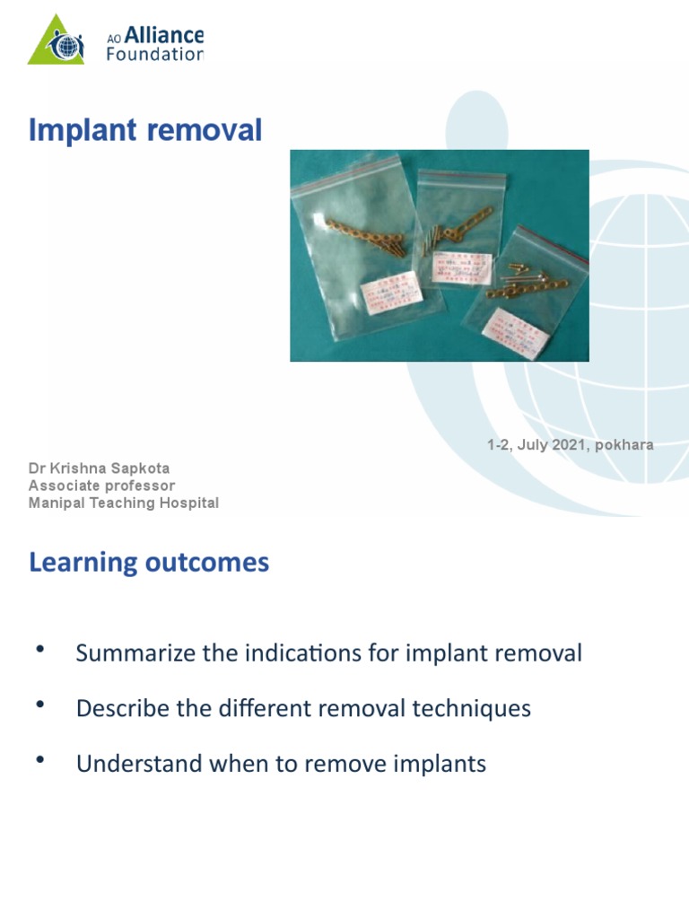 AOAF Implant Removal | PDF | Screw | Implant (Medicine)