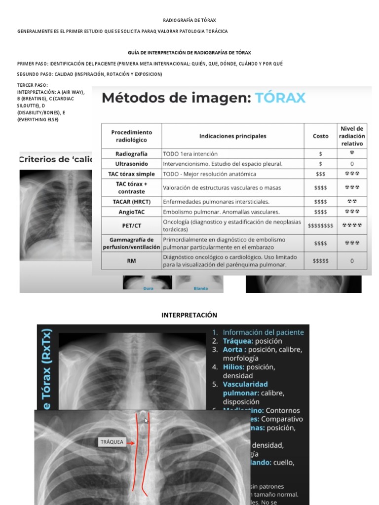 RX de Torax Normal | PDF