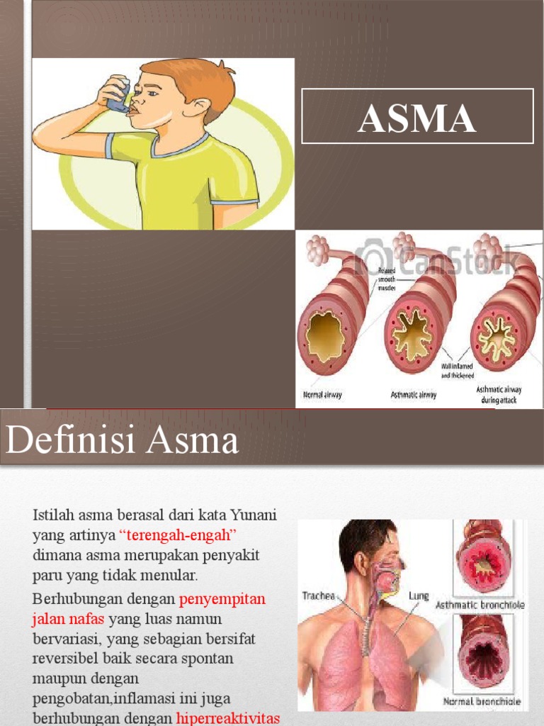 Panduan Lengkap Tentang Asma | PDF | Kesehatan Holistik | Sains ...