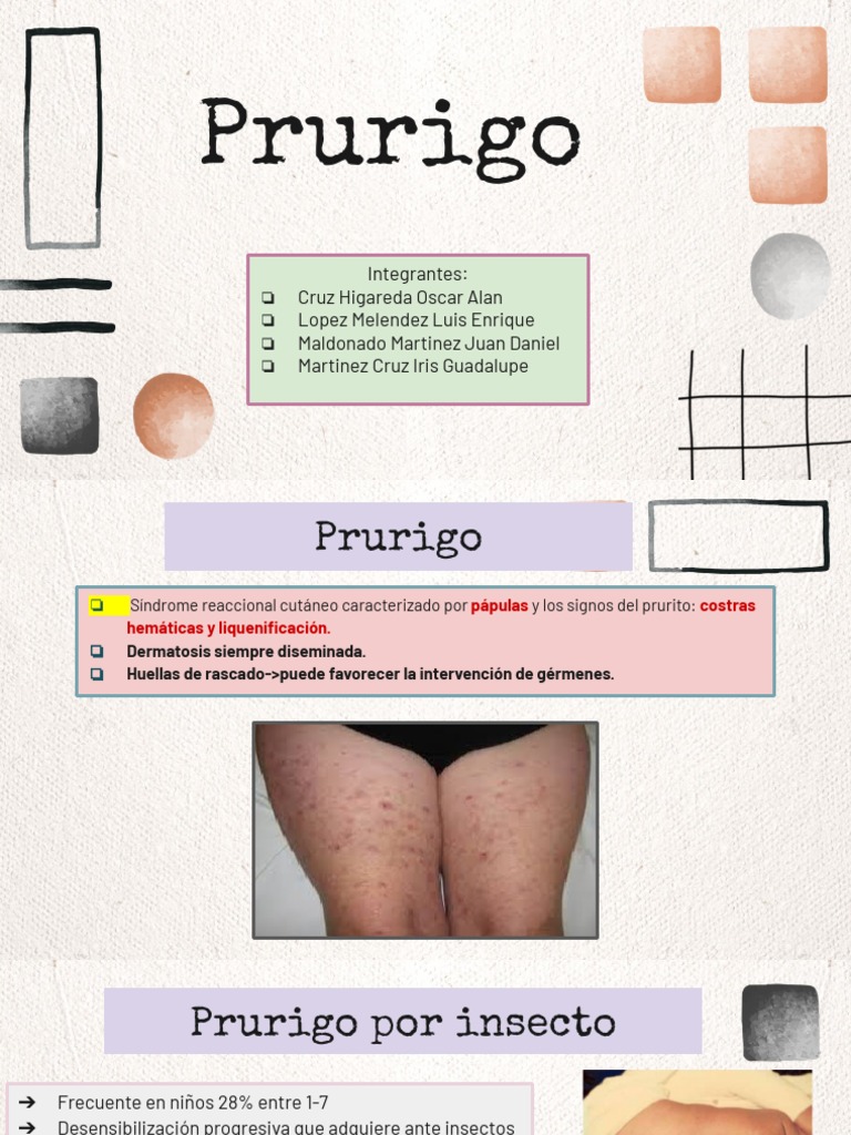 4 Prurigo | PDF | Piel | Especialidades Medicas
