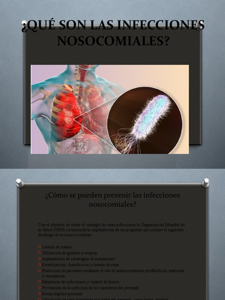 Infección Nosocomial, Qué Es Y Cómo Se Transmite – JYZXLK