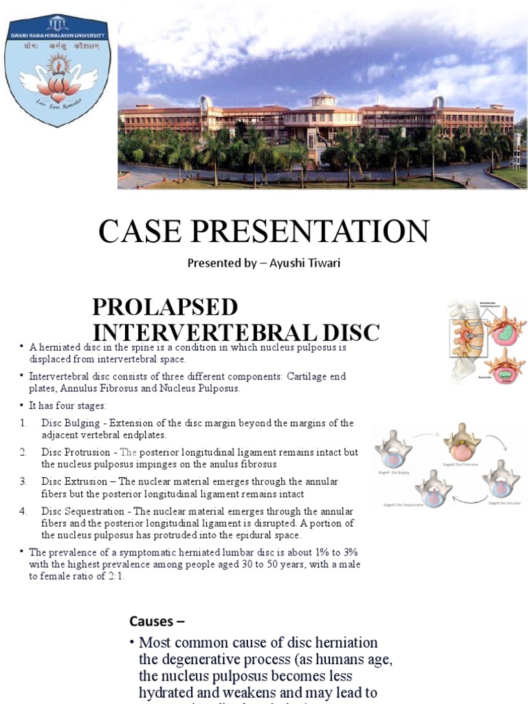 PIVD | PDF | Musculoskeletal System | Clinical Medicine