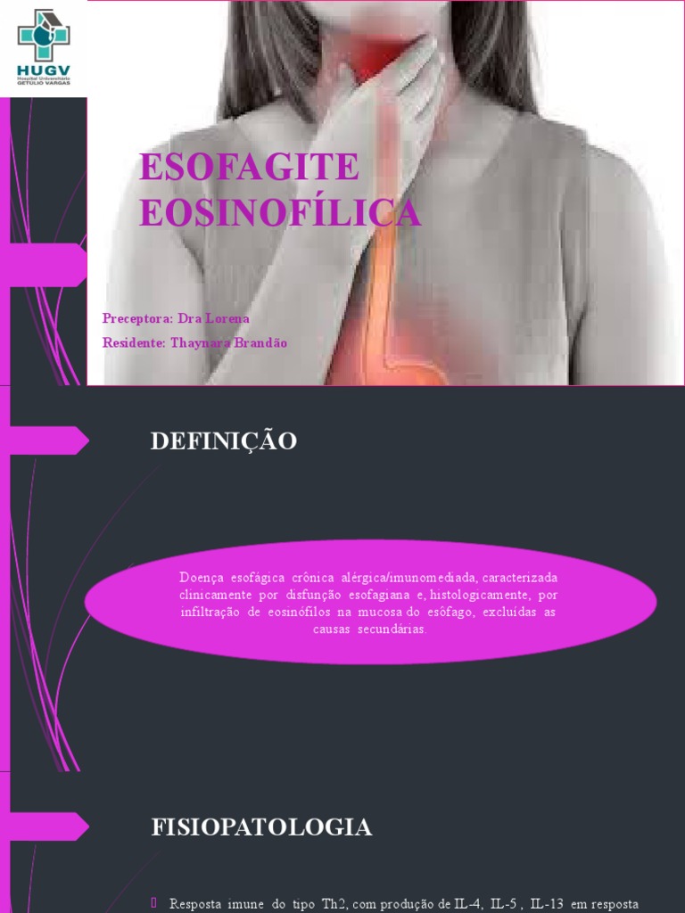 Esofagite Eosinofílica: Definição, Fisiopatologia, Epidemiologia ...