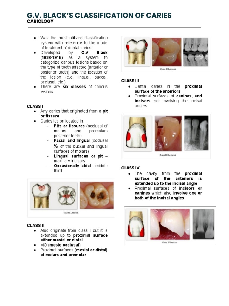 G.V. Black's Caries Classification Overview | PDF | Animal Anatomy ...