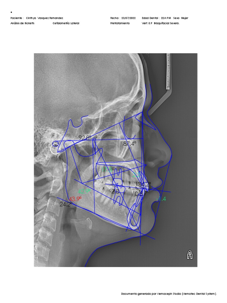 Cefalograma Ricketts | PDF