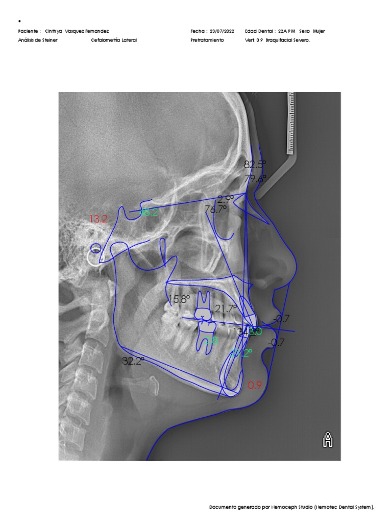Cefalograma Steiner | PDF