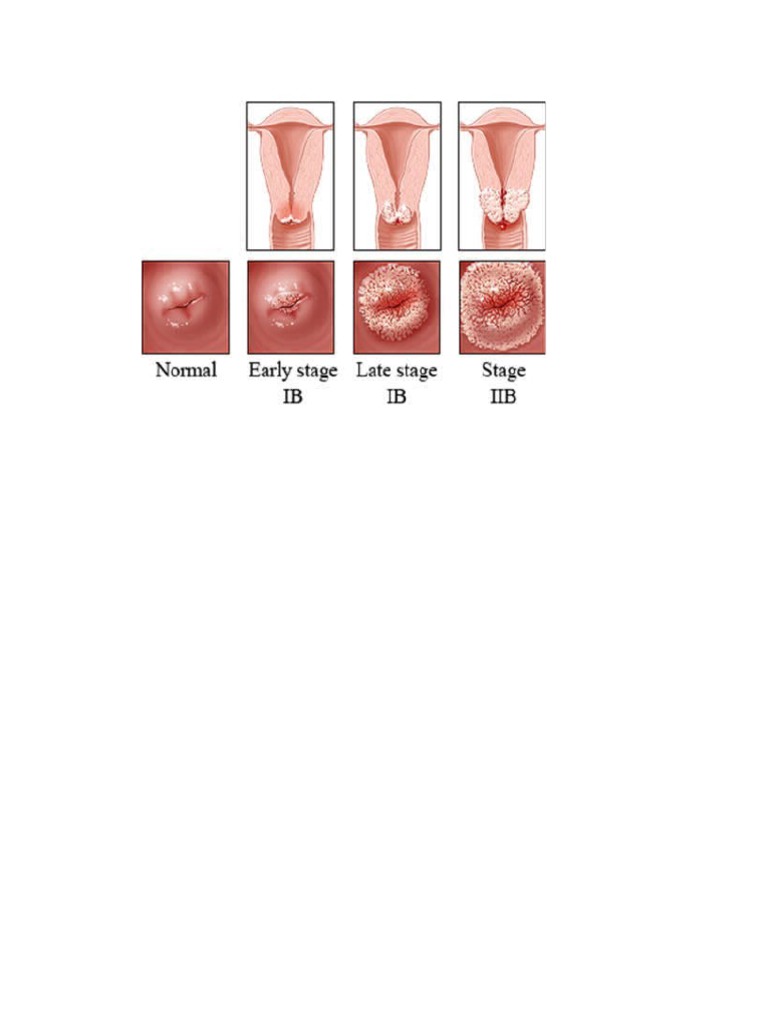Gambar Iva Test | PDF