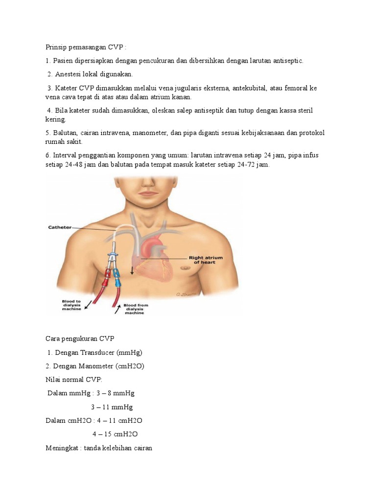 Lokasi Pemasangan Cpv. Kep Kritis | PDF