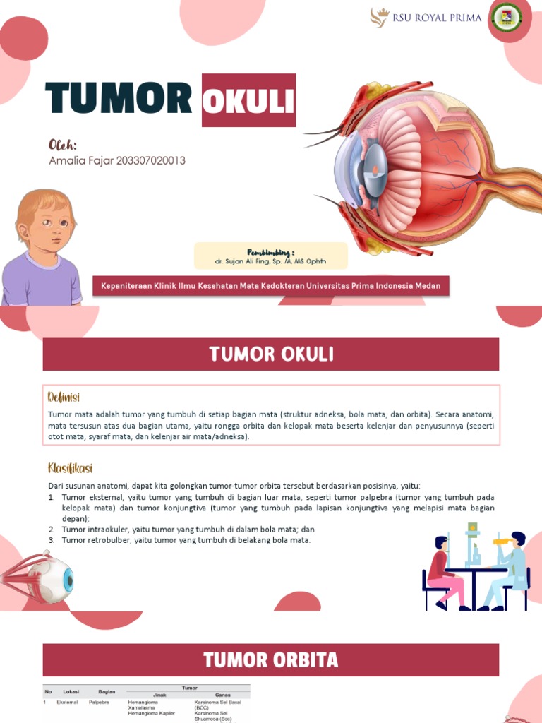 Paper Tumor Okuli (Amalia Fajar 203307020013) | PDF