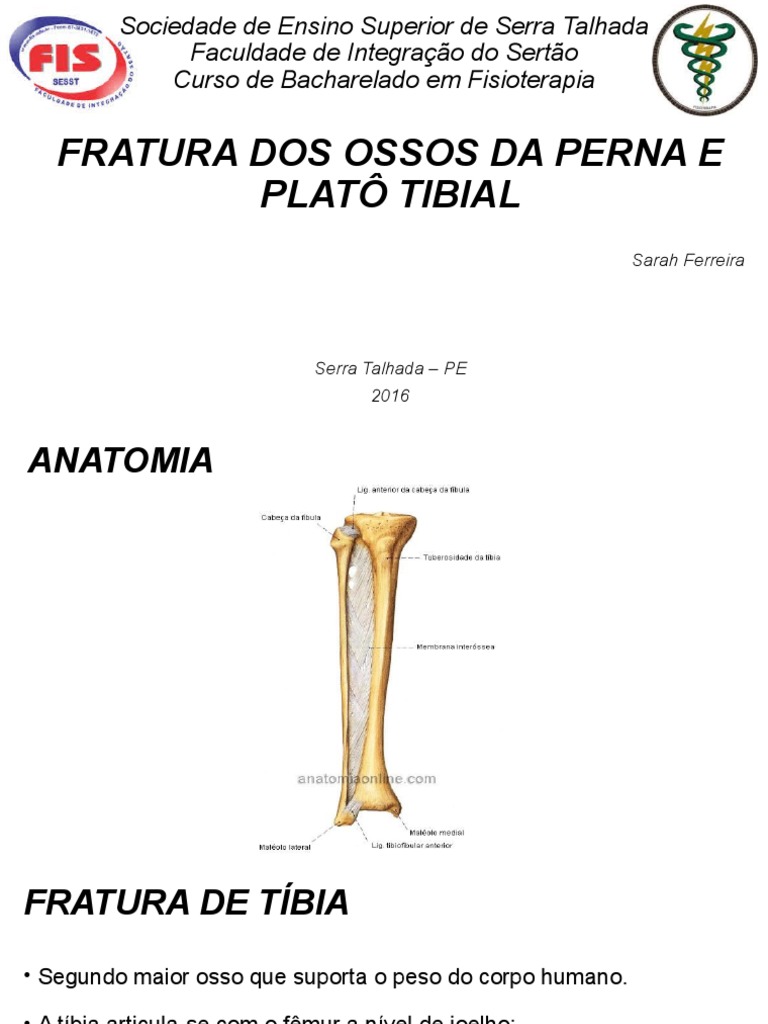 3 Fratura Dos Ossos Da Perna e Platô Tibial | PDF | Joelho | Causas de ...