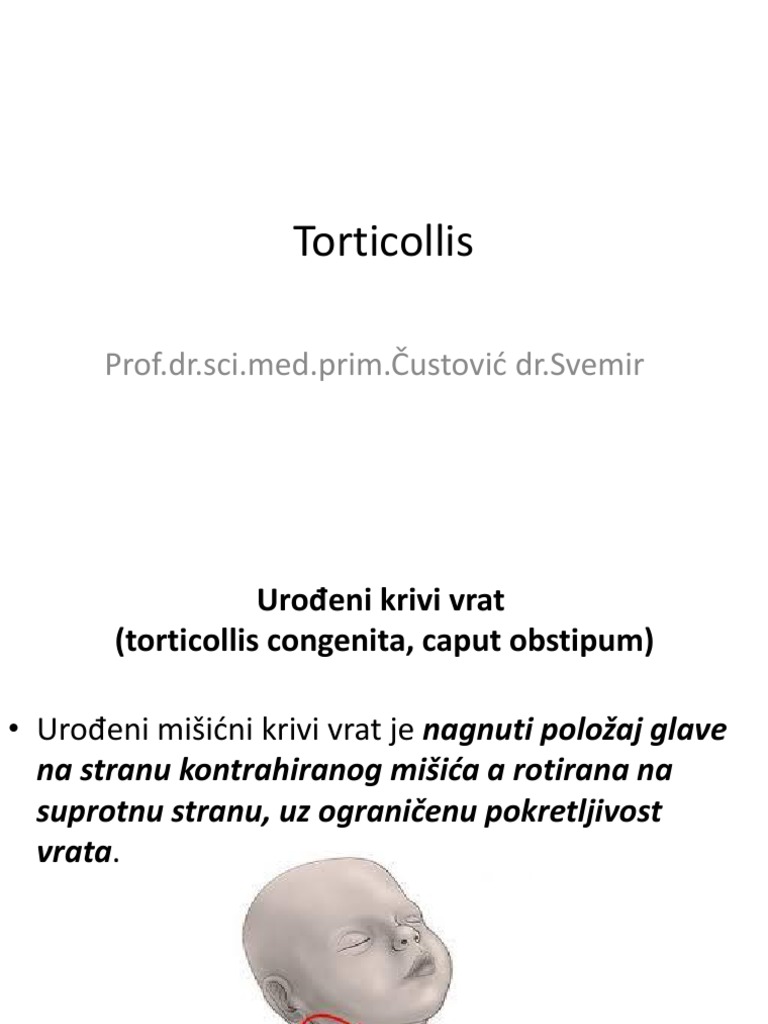 1.5 Torticollis | PDF