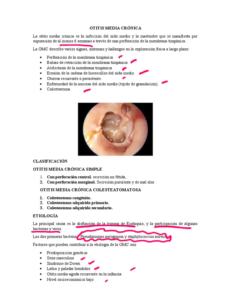 RESUMEN OTITIS MEDIA CRONICA | PDF | Oído | Síntoma