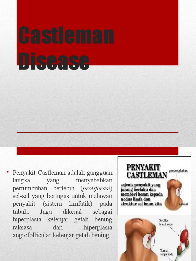 Castleman Disease | PDF | Sains & Matematika