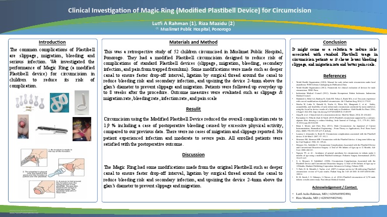 Poster Clinical Investigation of Magic Ring (Modified Plastibell Device ...
