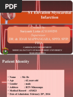 648a387ee8b9fa73809c0d47 - Normal ECG Values Chart Sample | PDF