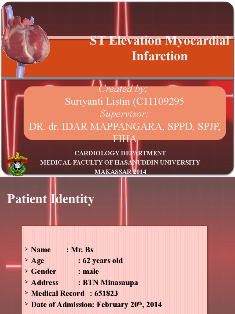 STEMI | Download Free PDF | Myocardial Infarction | Coronary Artery Disease