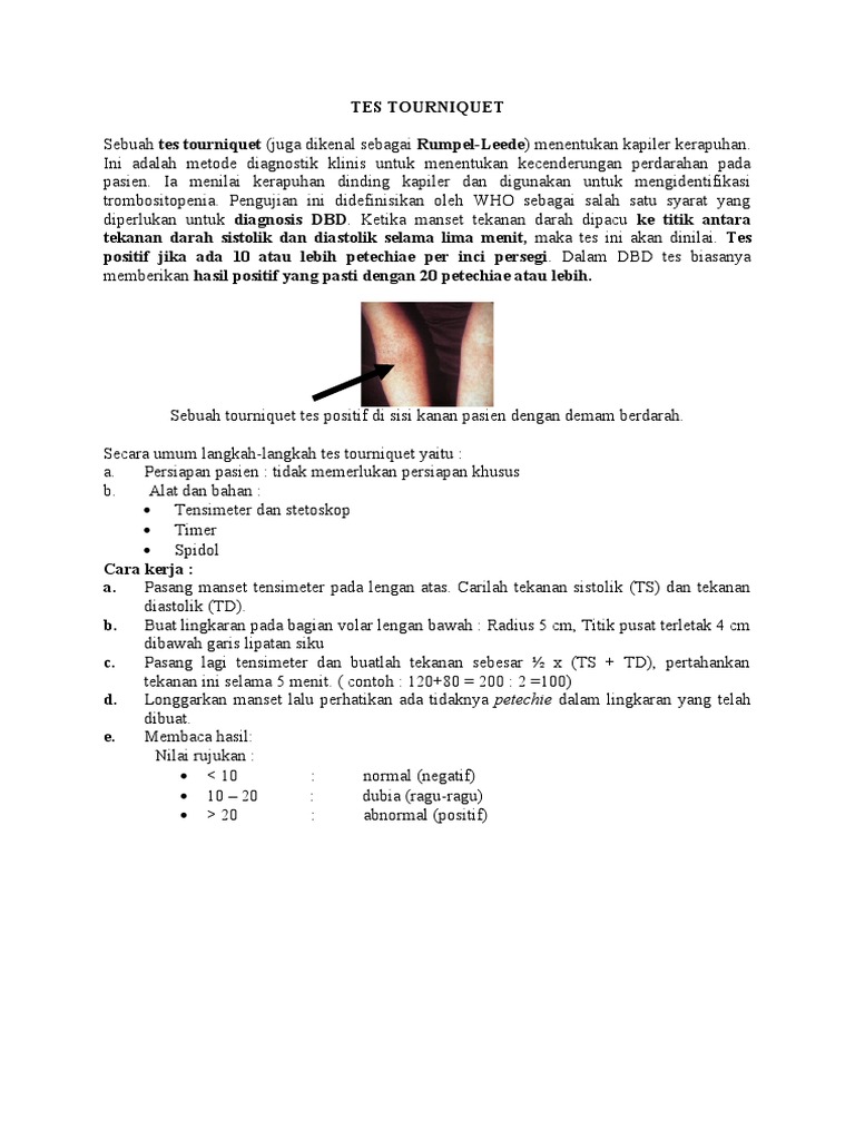 Uji Tourniquet untuk Diagnosa DBD | PDF | Sains & Matematika