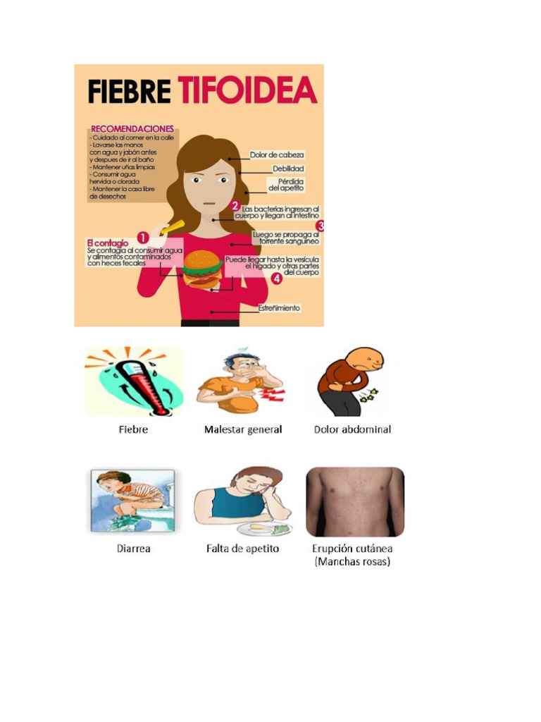 Fiebre Tifoidea | PDF