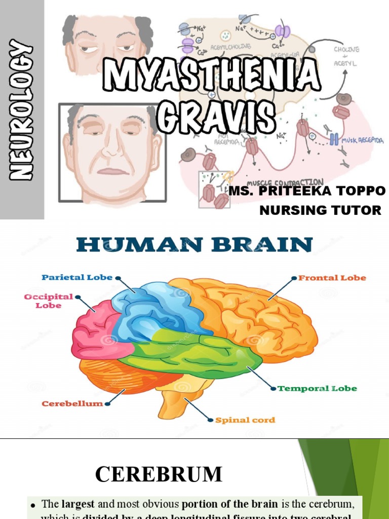Myasthenia Gravis | PDF