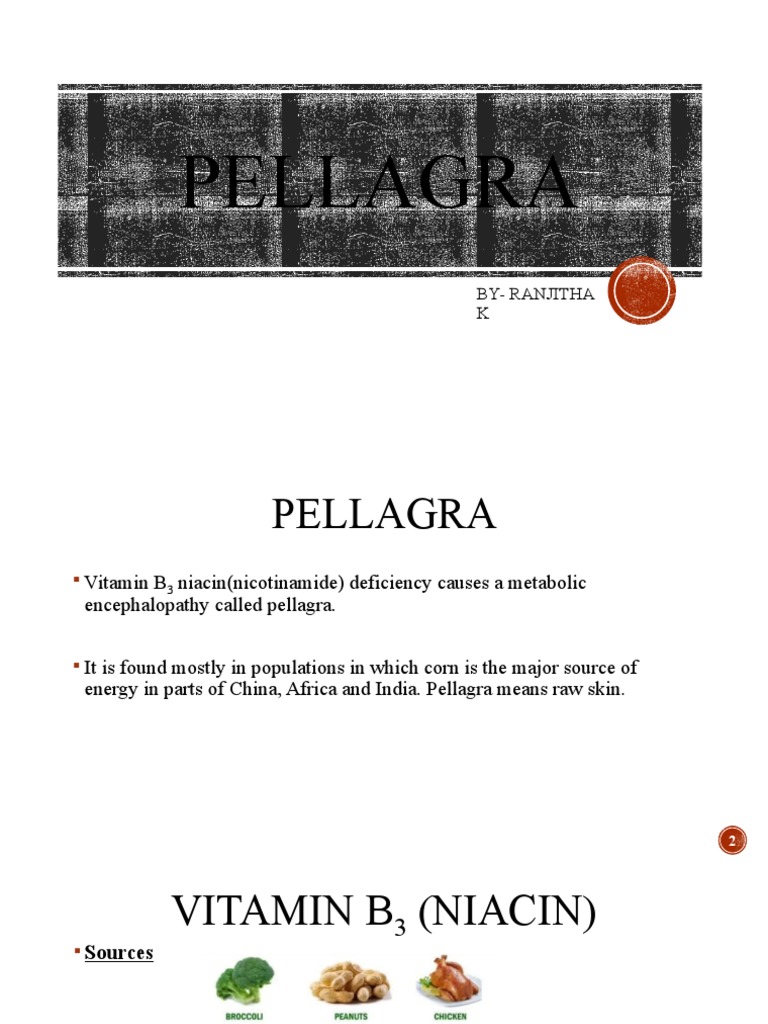Pellagra | Download Free PDF | Medicine | Human Diseases And Disorders