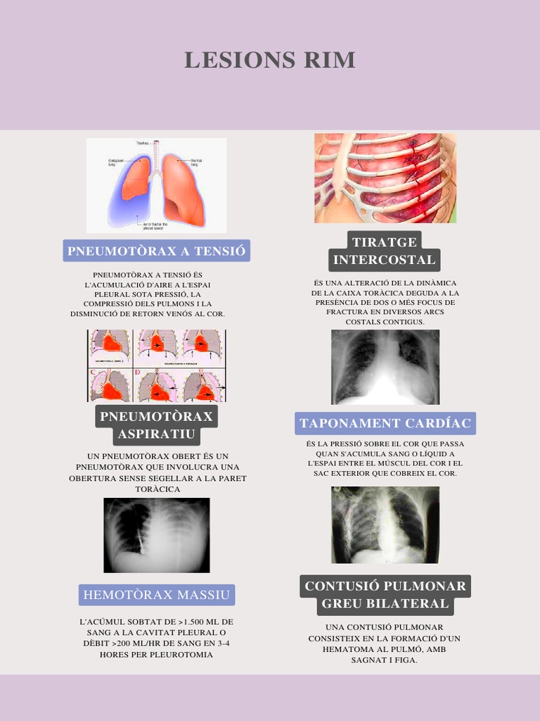 Lesions RIM I Malaties de L'aparell Respiratòri | PDF
