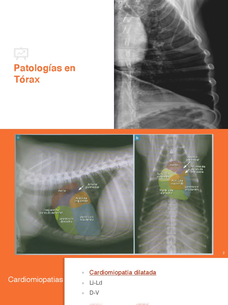 Patologías torácicas: presentación de casos clínicos y hallazgos ...