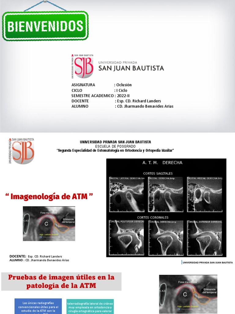 PDF Exposición Imagenologia de Atm | PDF | Ct Scan | Imagen de resonancia magnética