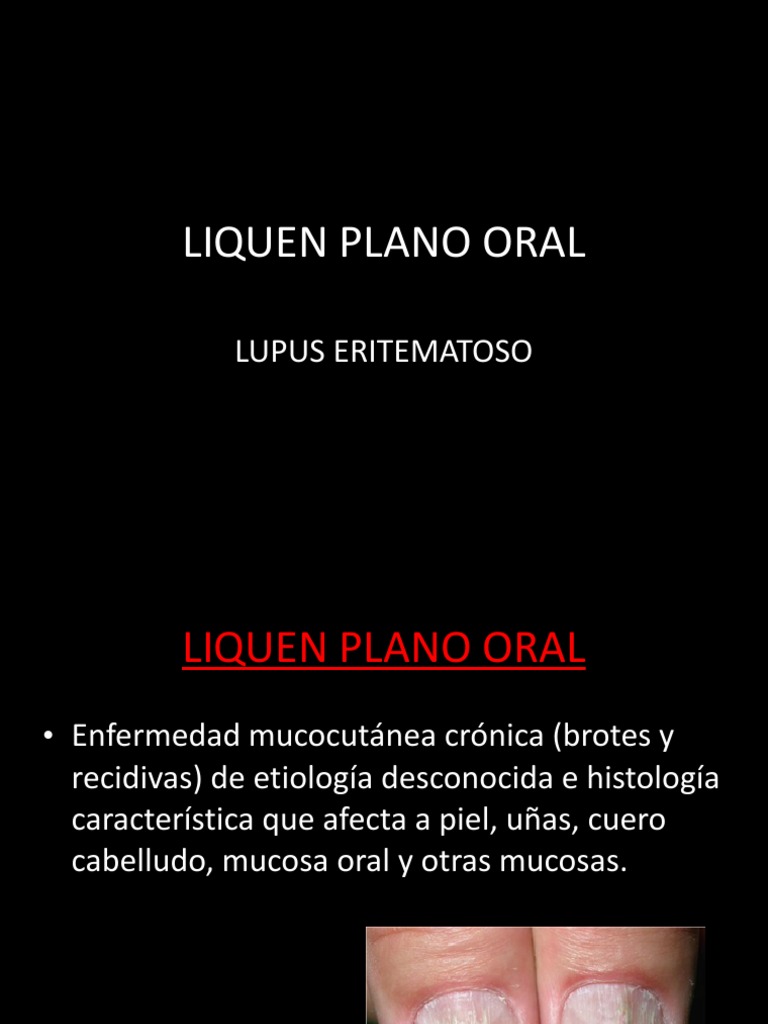 Tema 11 y 12 Liquen Plano Oral | PDF | Cáncer | Epidemiología