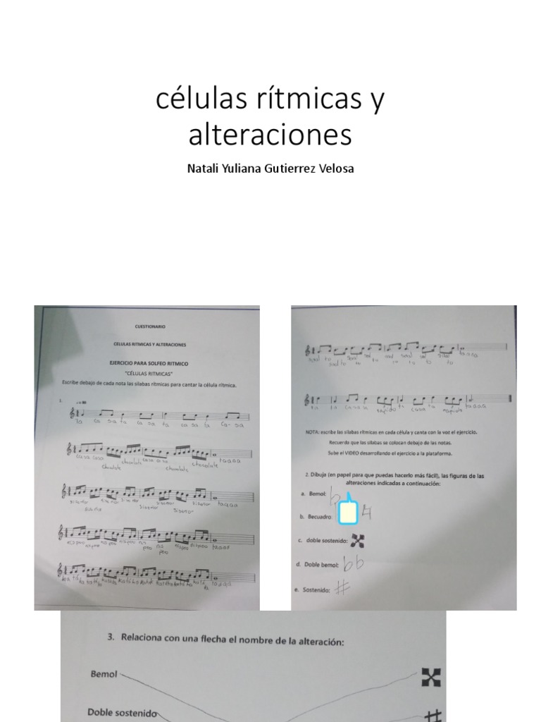 Células Rítmicas y Alteraciones | PDF
