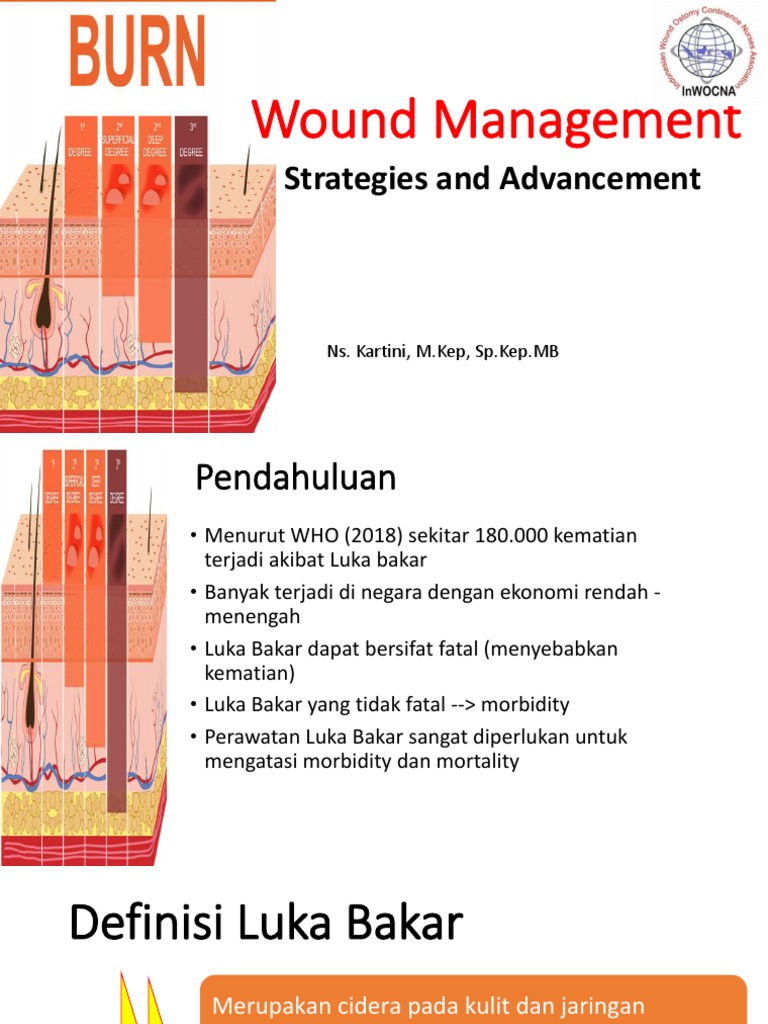 Burn Wound Management 21 | PDF