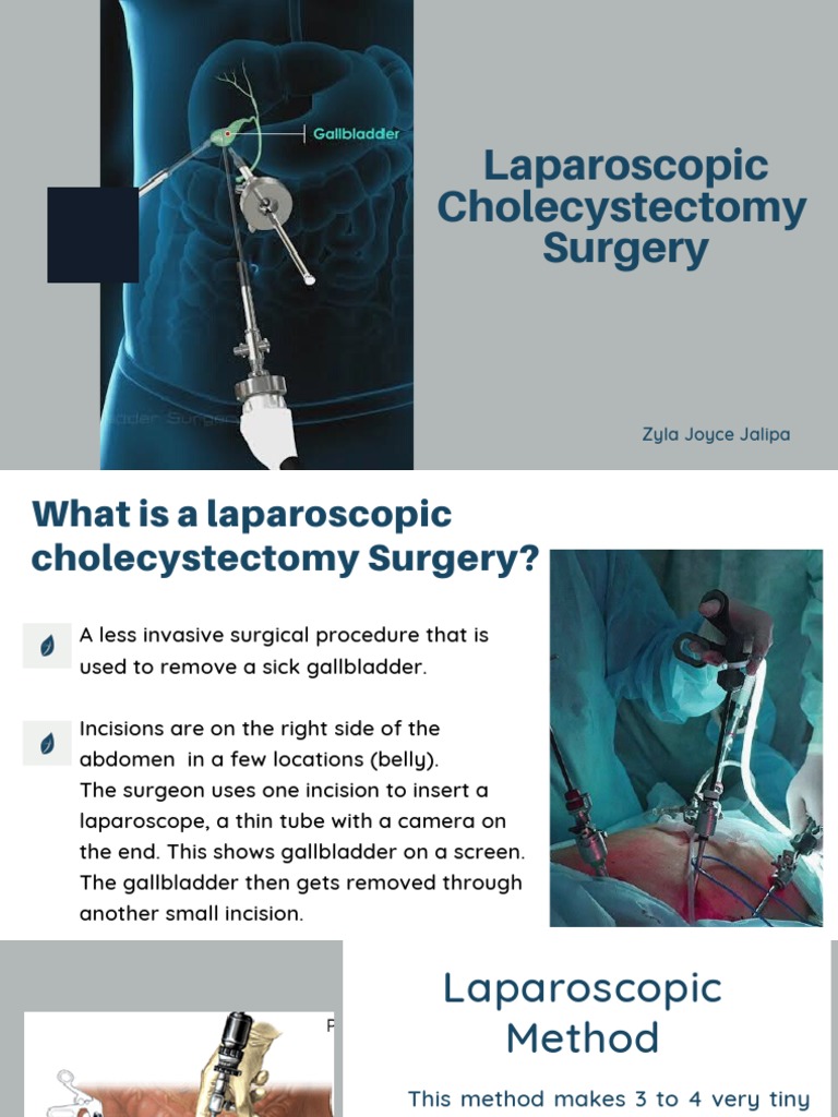Laparoscopic Cholecystectomy Surgery | PDF | Gallbladder | Diseases And ...