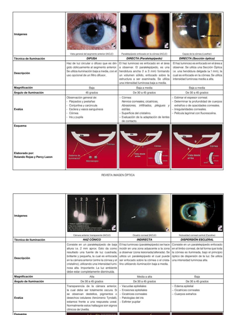 PDF Tecnicas de Iluminacion en Lampara de Hendidura Biomicros | PDF