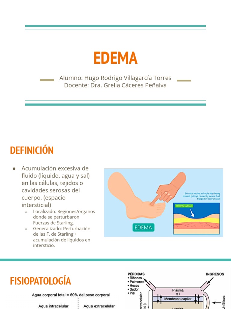 EDEMA | PDF | Edema | Especialidades Medicas