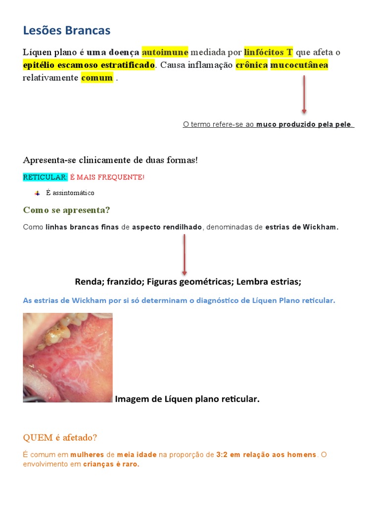 Histologia Do Leucoedema Variações Da Anatomia Oral E Afecções
