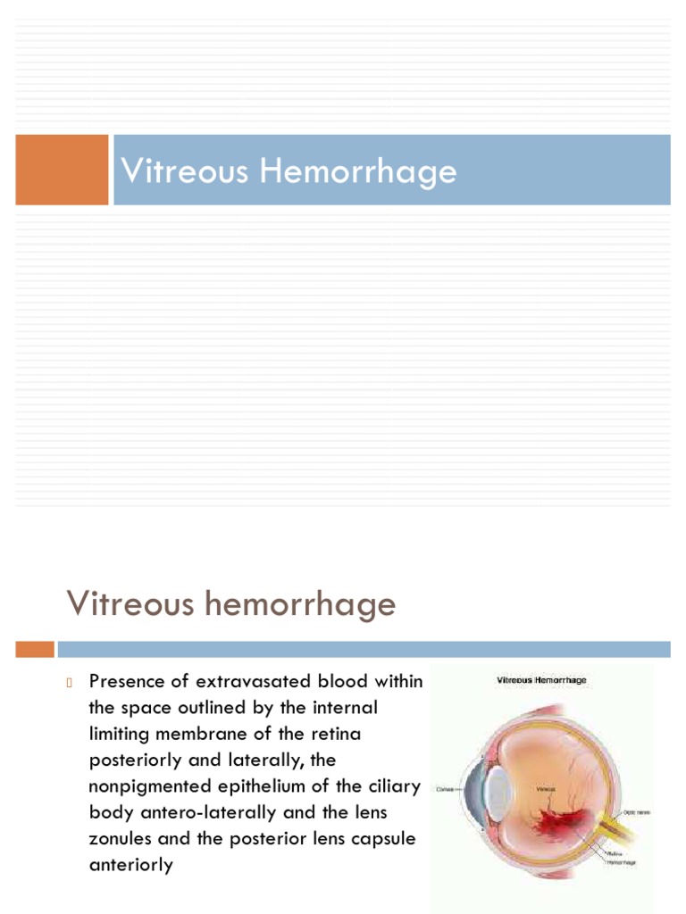Vitreous Hemorrhage | Retina | Blood Vessel