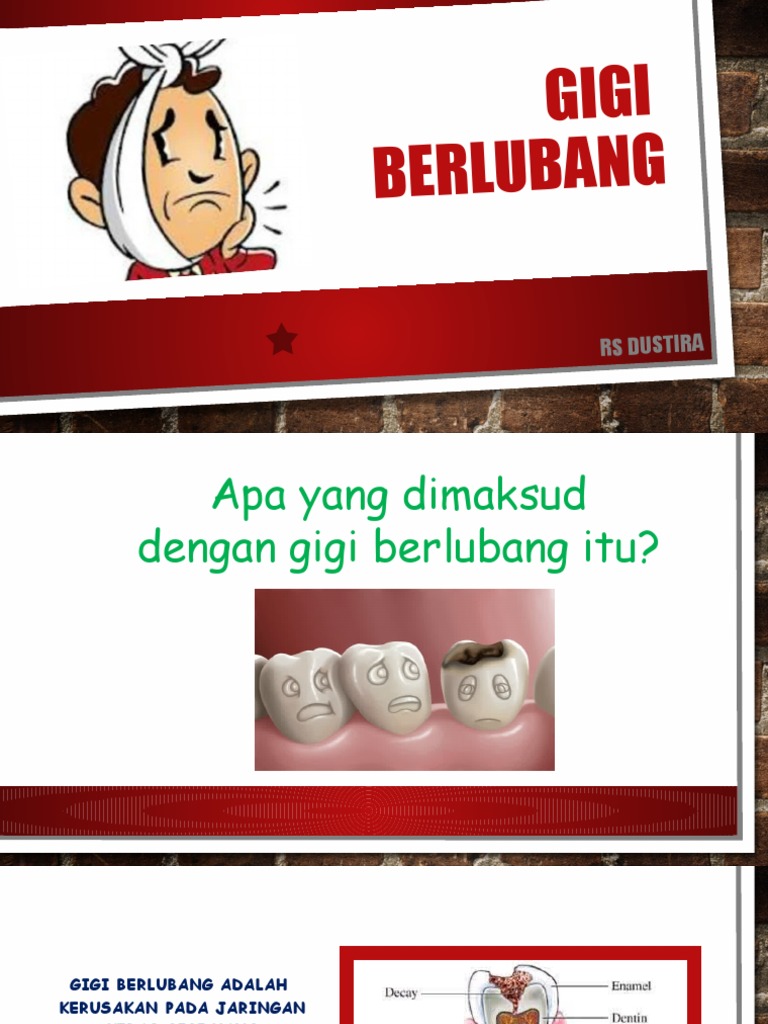 Cara Mencegah dan Mengatasi Gigi Berlubang | PDF