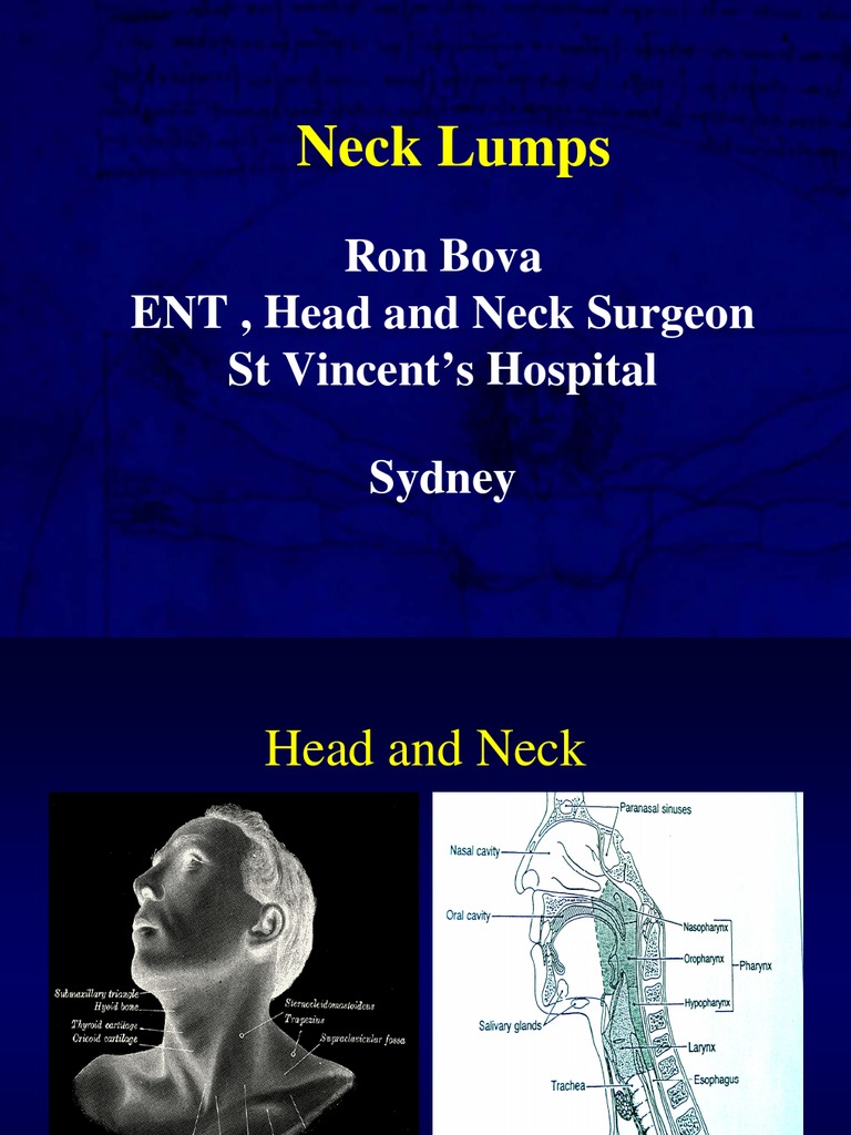 Neck Lumps: Ron Bova ENT, Head and Neck Surgeon ST Vincent's Hospital ...
