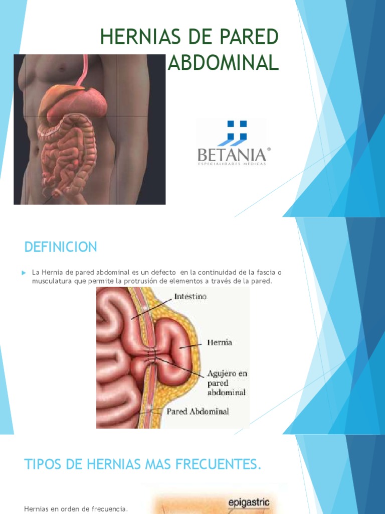 Tipos y tratamiento de hernias abdominales | PDF | Especialidades Medicas | Medicina CLINICA