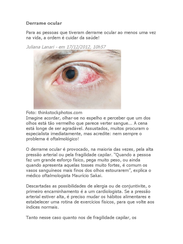 Derrame Ocular | PDF | AVC | Hipertensão