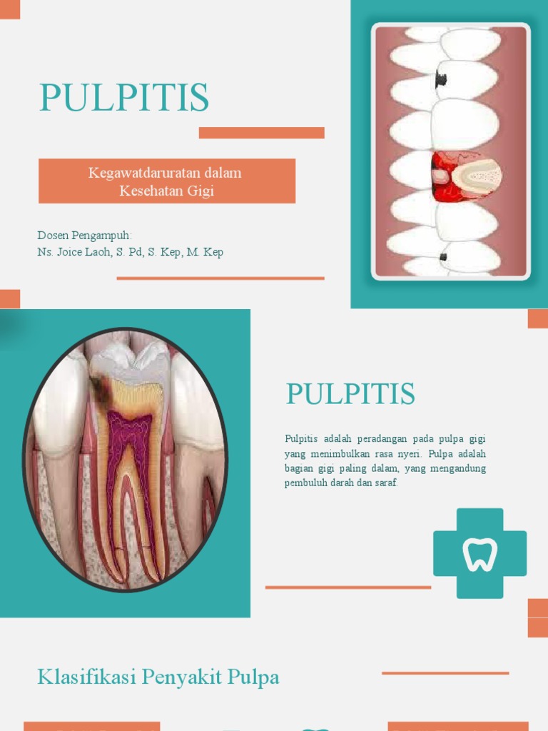 Pulpitis Gadar | PDF