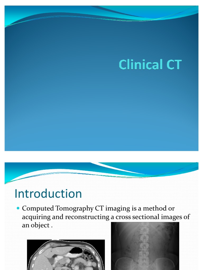 CT Scan | PDF | Ct Scan | Image Scanner