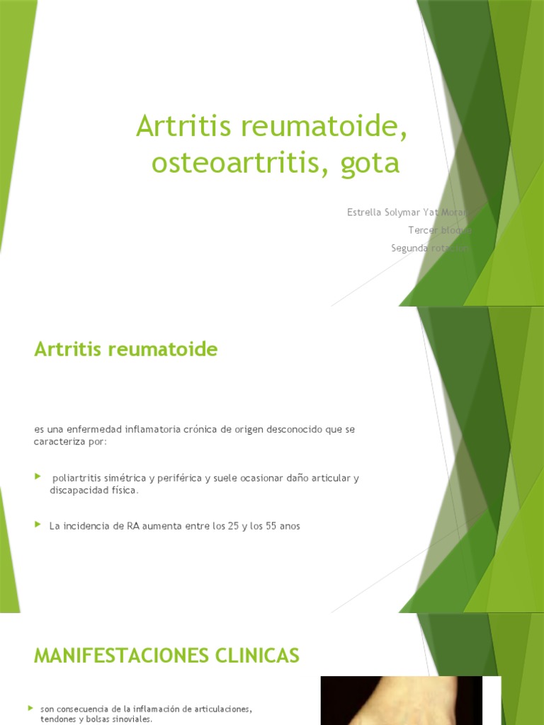 Art Ritis | PDF | Artritis Reumatoide | Gota