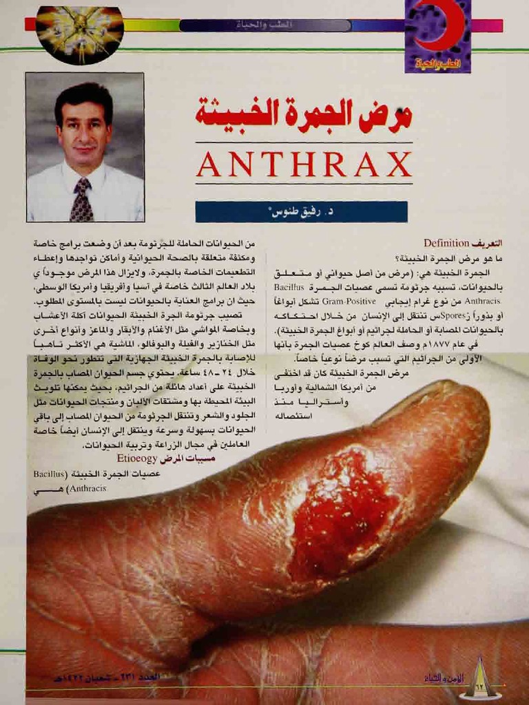مرض الجمرة الخبيثة Anthrax | PDF